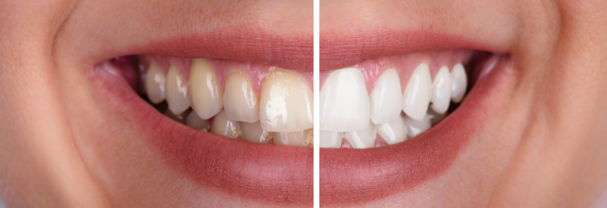 Riverside Dental Practice - Your Trusted Stafford Dentist